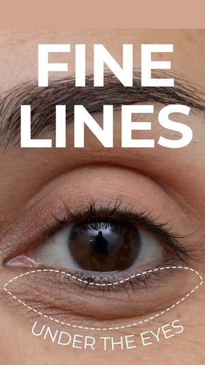 Best Under Eye Anti Wrinkle Cream | Eye Cream for Wrinkles Under Eyes ...